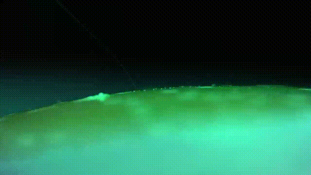 一文读懂马斯克的脑机接口硬科技-Neuralink有可能包治“脑”病吗？ - 知乎