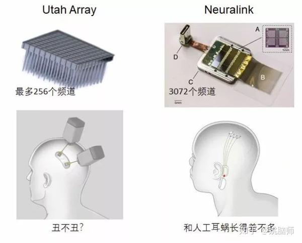 Neuralink脑机接口：舍近求远的不归路？ - 知乎