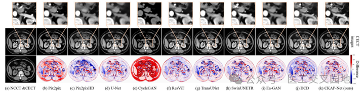 南方医科大学的杨魏团队提出NCCT合成CECT与对比度增强知识和解剖感知在非对比CT图像中进行多器官分割 - 知乎