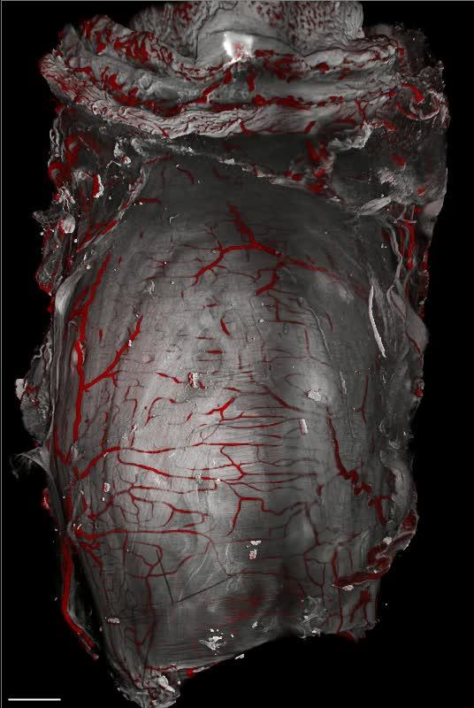 ImageJ实用技巧——3D渲染动画(插件篇) - 知乎