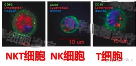 科普 | NK细胞、T细胞、NKT细胞有区别吗？ - 知乎