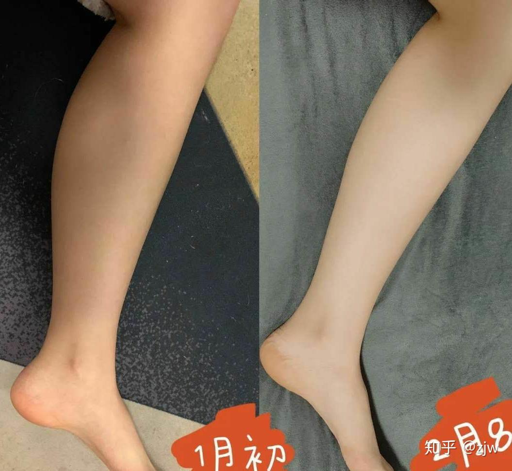 小腿肚肉多,怎样可以快速瘦下来。? 知乎