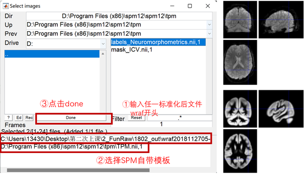 fMRI数据预处理 - 知乎