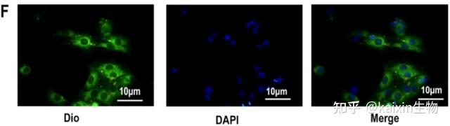 常见亲脂性细胞膜染料DiO, Dil, DiR, Did光谱图和实验操作流程 - 知乎
