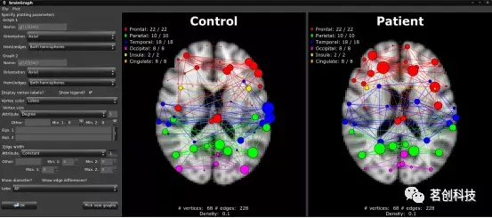 R语言绘图：实用脑科学数据可视化包 - 知乎