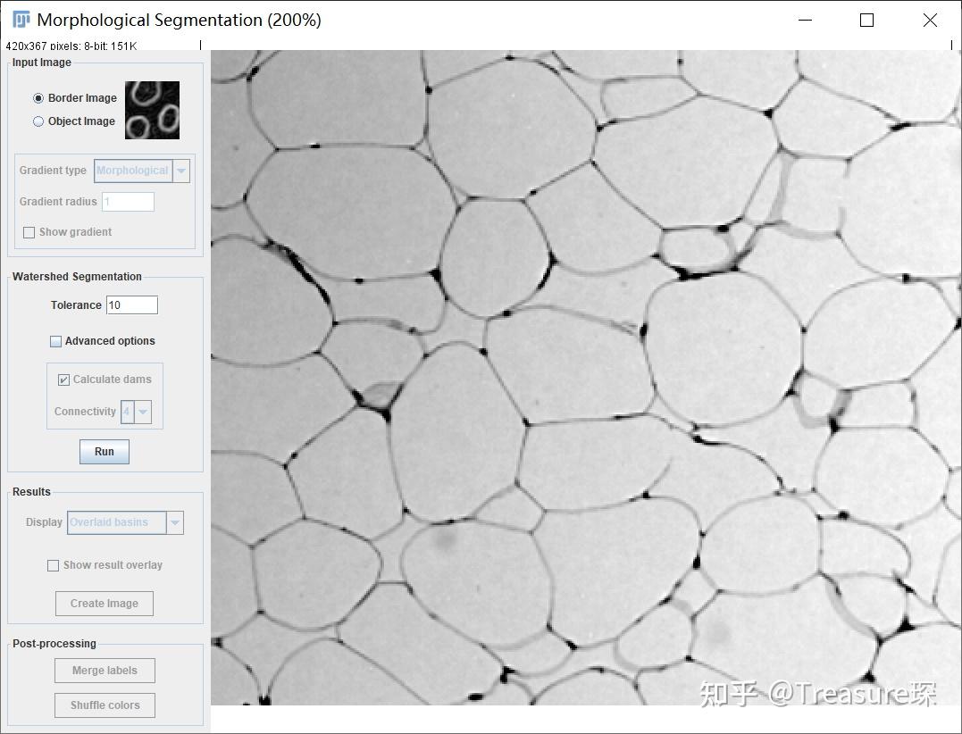 ImageJ实用教程——边缘检测图像分割(案例分析篇) - 知乎