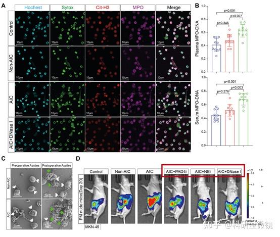 通过多篇10+高分文献结果揭示国自然热点中性粒细胞胞外诱捕网（NETs）相关实验 - 知乎