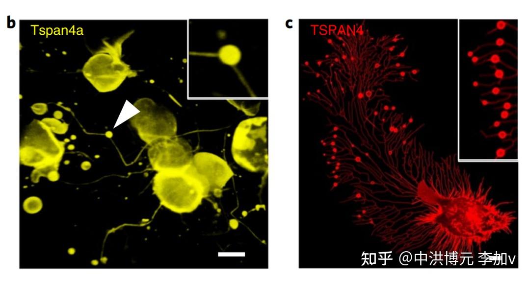 概述 | 国自然的一新热点：新型细胞器「迁移体」，有别于外泌体 - 知乎
