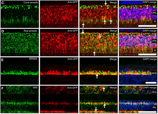 【耀文解读】mRNA篇-Science子刊新进展肽偶联LNP将mRNA靶向递送至光感细胞 - 知乎