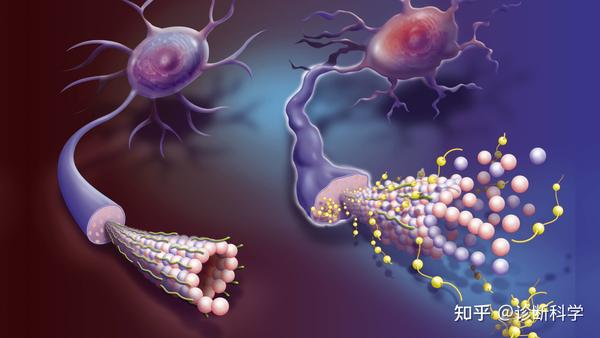 前沿 | 生物标志物+基因组学+蛋白组学！阿尔兹海默症诊断测试头对头一期对比研究将于2023年7月发布！ - 知乎