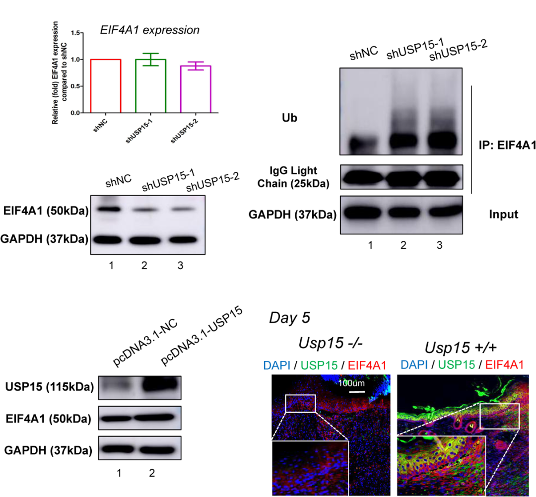 USP15在皮肤伤口修复过程中通过去泛素化EIF4A1增强再上皮化 - 知乎