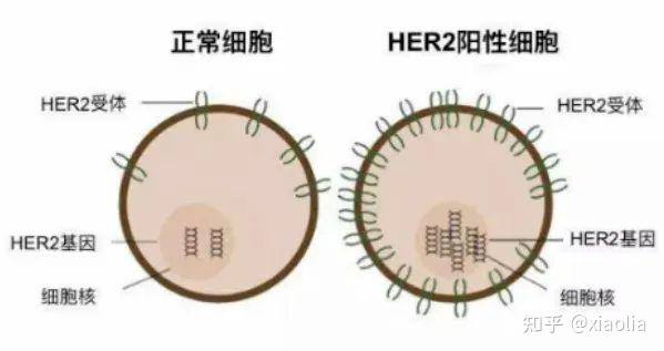 HER2阳性乳腺癌，需要强化治疗吗？ - 知乎