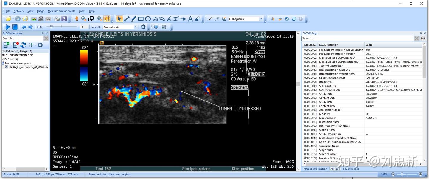 DICOM学习笔记（三方库DCMTK） - 知乎
