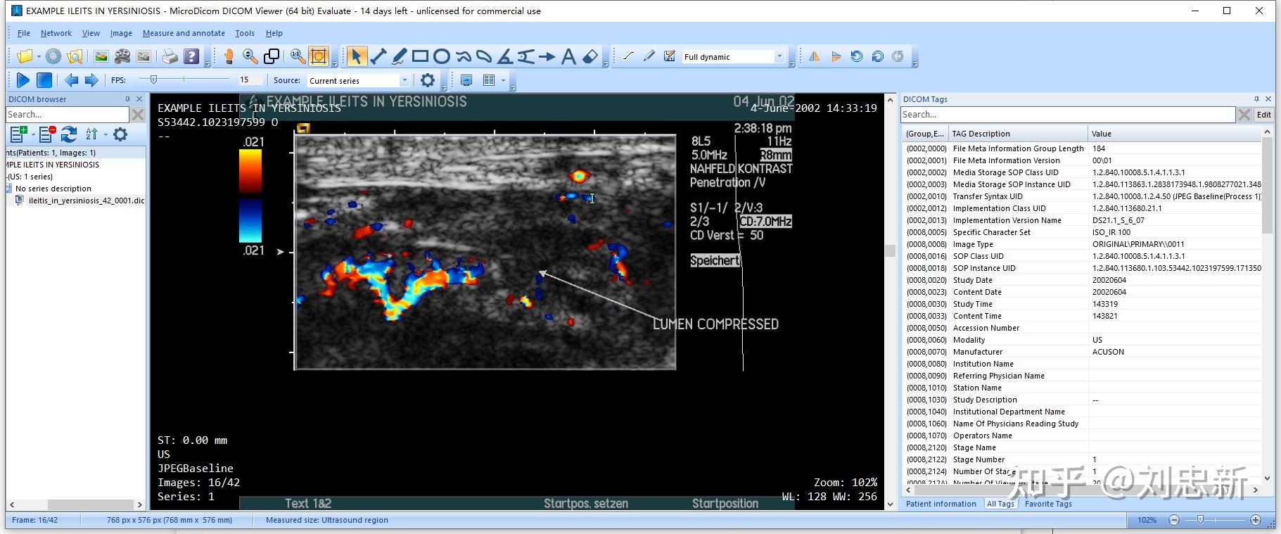 DICOM学习笔记（三方库DCMTK） - 知乎