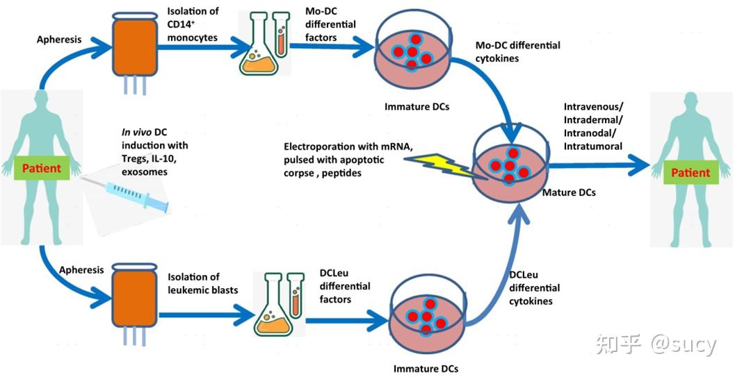 DC细胞疗法，CIK细胞疗法与DC-CIK细胞疗法 - 知乎