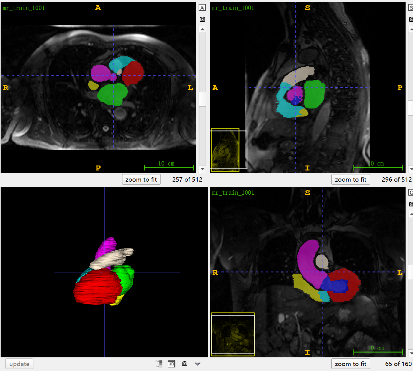 MM-WHS 数据集介绍 - 知乎