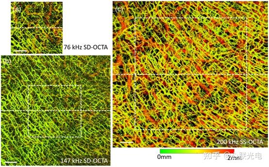 J Biomed Opt：长距离swept-source OCTA在皮肤微循环成像方面的优越性 - 知乎
