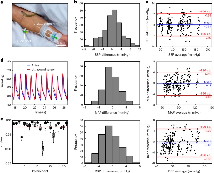 Nature BME | 可穿戴式血压超声传感器临床检测安全性与准确性得到了验证 - 知乎