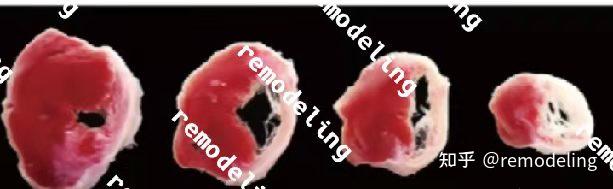 心肌梗死TTC检测 - 知乎