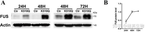 渐冻症研究新进展——FUS基因突变导致骨骼肌脂代谢紊乱！ - 知乎