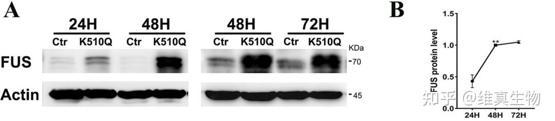 渐冻症研究新进展——FUS基因突变导致骨骼肌脂代谢紊乱！ - 知乎