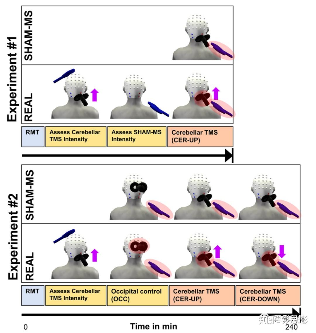 使用TMS-EEG评估小脑与大脑皮层的有效连接性 - 知乎