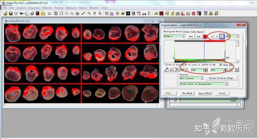 基础医学实验：TTC染色详细计算分析过程，步骤详解（组图） - 知乎