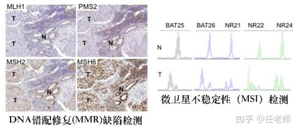 PDL-1，TMB，MSI 这些到底是什么？有什么意义？ - 知乎