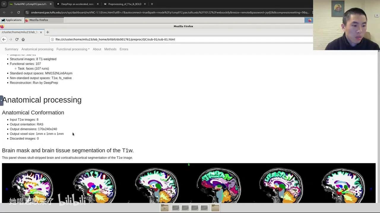 DeepPrep-基于深度学习的fMRI预处理工具 - 知乎