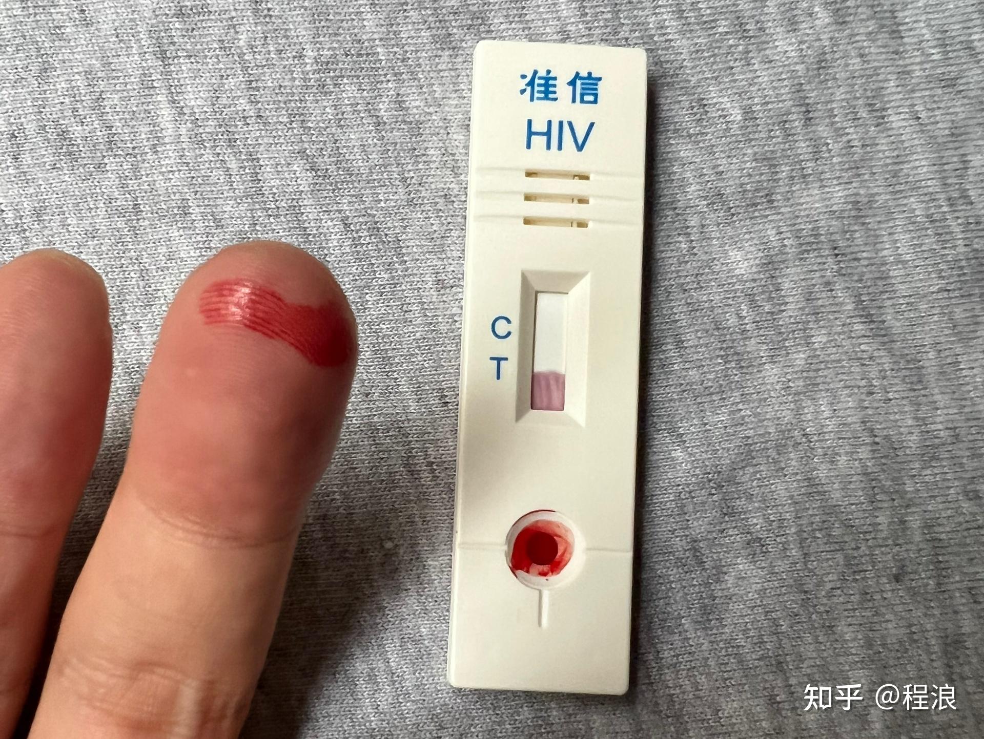 「准信」HIV艾滋病检测试纸评测 - 知乎