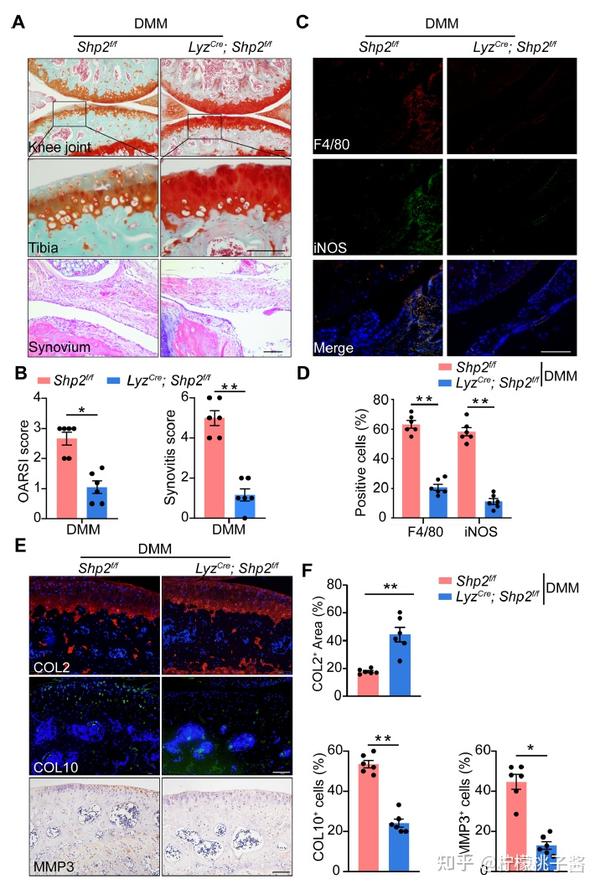 南京大学史冬泉/孙洋团队发现骨关节炎进展的新机制 - 知乎