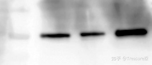 ImageJ实用技巧——Western Blot定量分析深入探究(定量分析篇) - 知乎