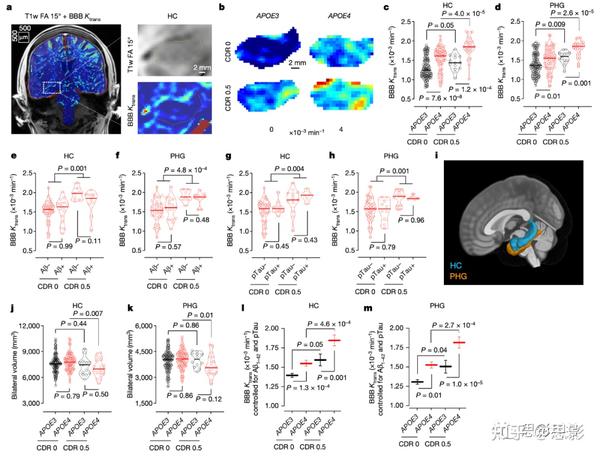 Nature：APOE4诱发血脑屏障功能障碍可预测认知功能下降 - 知乎