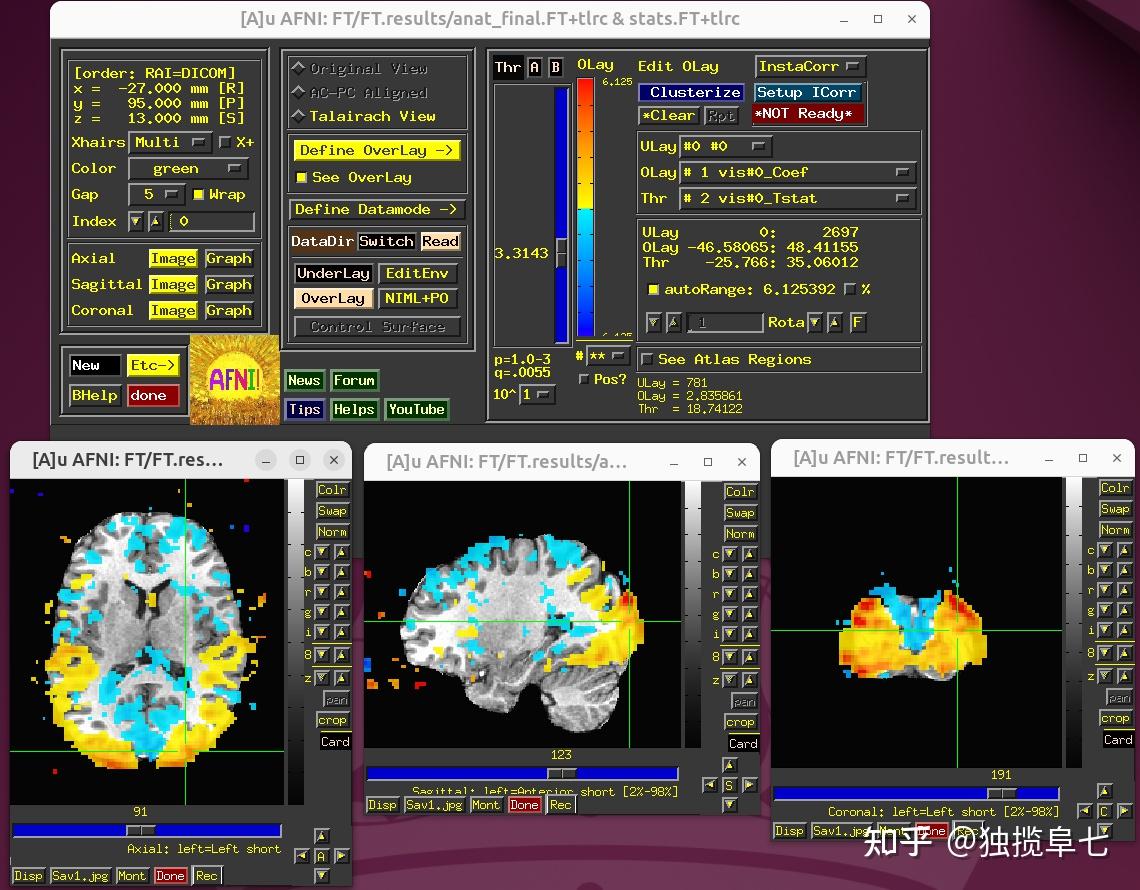 用AFNI处理fMRI数据 - 知乎