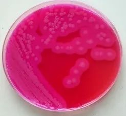 AIculture慧养® | GB 4789.14-2014国标法中蜡样芽胞杆菌的检验步骤分享 - 知乎