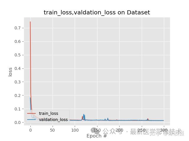 VESSEL2012——肺血管分割 - 知乎