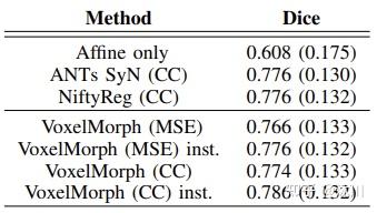 图像配准-VoxelMorph - 知乎
