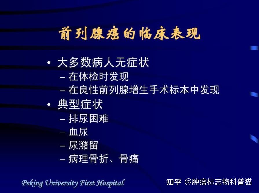 前列腺癌的肿瘤标志物PSA、F-PSA - 知乎