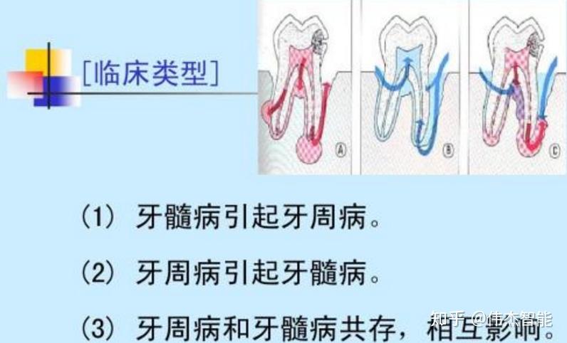 17年了，“8020计划”你了解吗 - 知乎