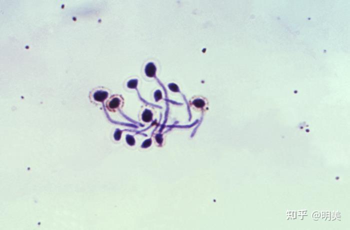 显微镜下的白假丝酵母菌 - 知乎