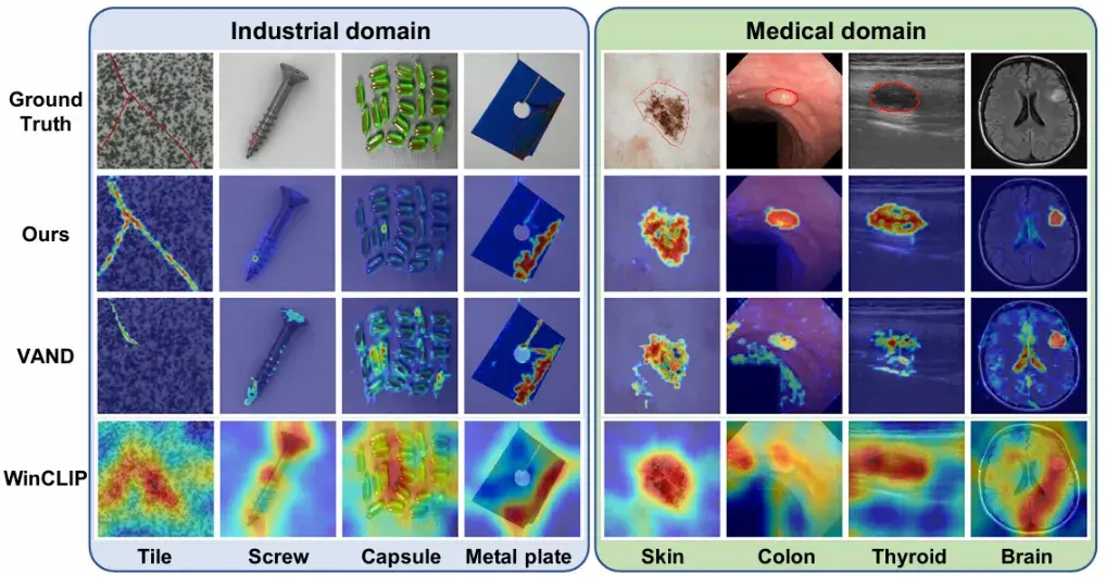 ICLR 2024 | 跨领域准确进行零样本异常检测，浙大等提出AnomalyCLIP - 知乎