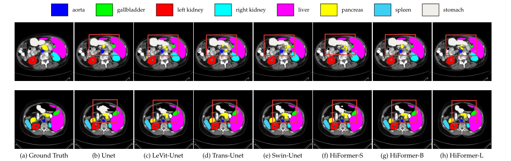HiFormer: Hierarchical Multi-scale Representations Using Transformers for Medical Image ...