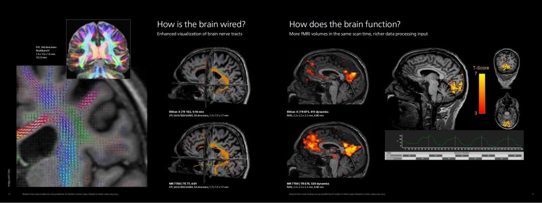 最新！飞利浦磁共振成像系统MR 7700获FDA批准 - 知乎