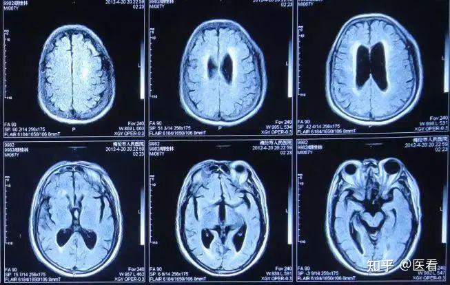 这六大MRI读片技巧，影像医生必须掌握 - 知乎