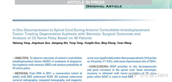 名医专访|上海长征医院脊柱外科缪锦浩：颈前路椎体骨化韧带前移融合术ACAF - 知乎