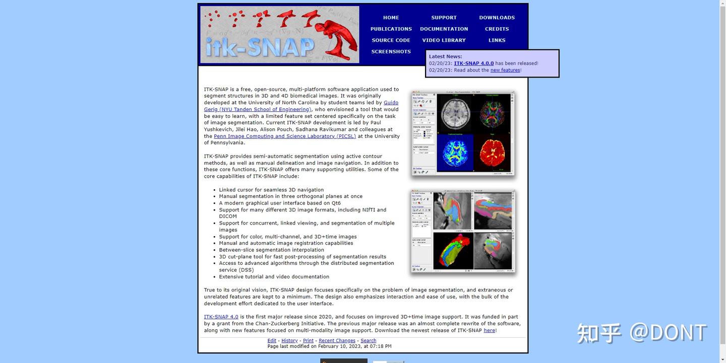 医学影像常用工具 ITK-SNAP - 知乎