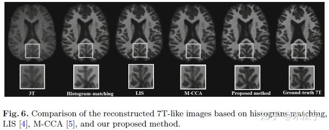 医学图像MRI增强相关论文 - 知乎
