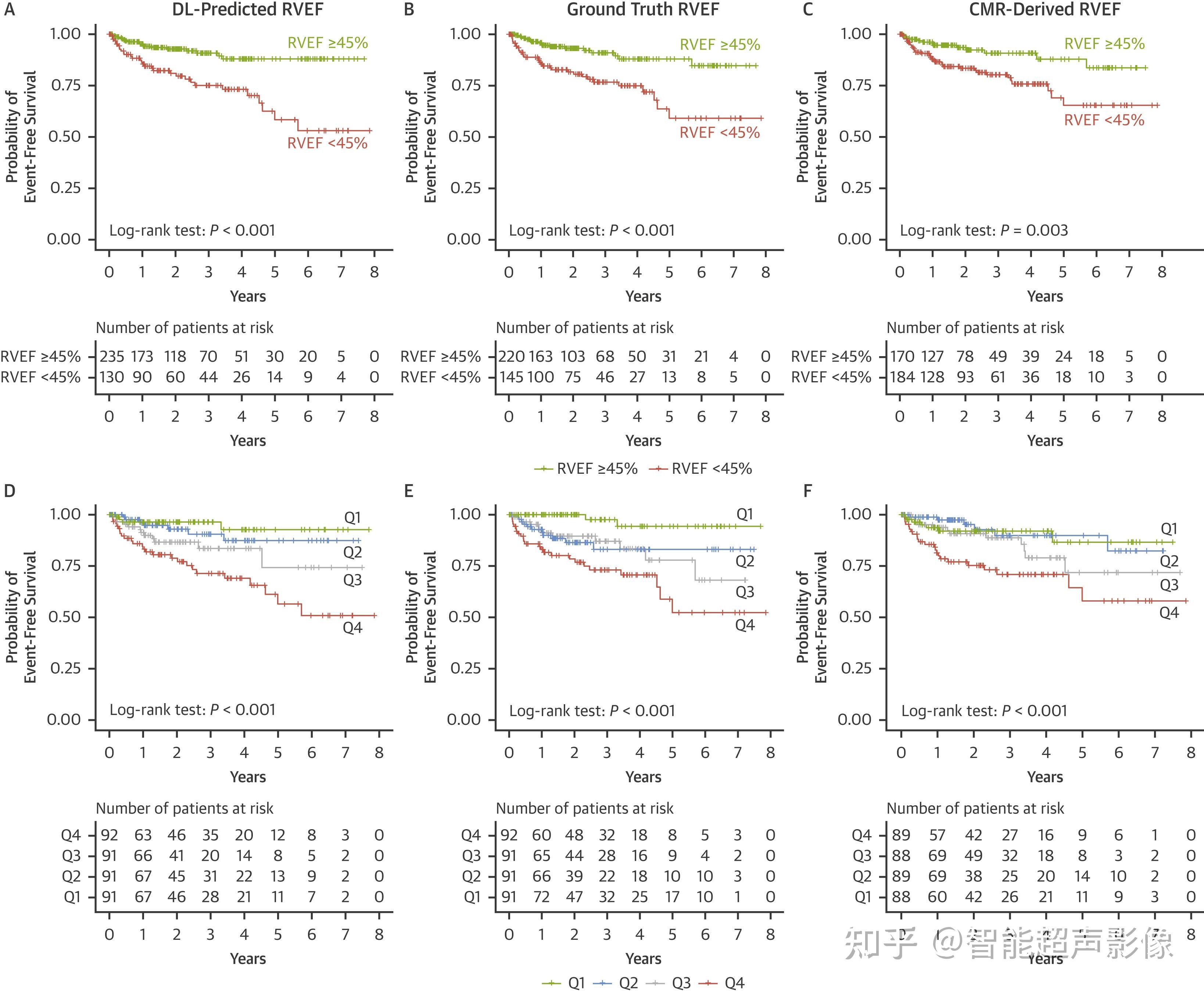 二维超声心动图无法评估右心室射血分数RVEF？ - 知乎
