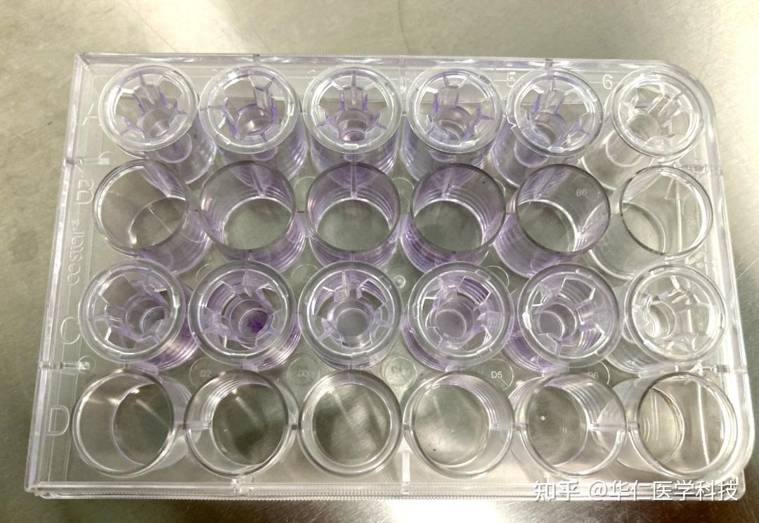 从青铜到王者，科研小白的进阶之路（5）——Transwell细胞侵袭实验教程 - 知乎