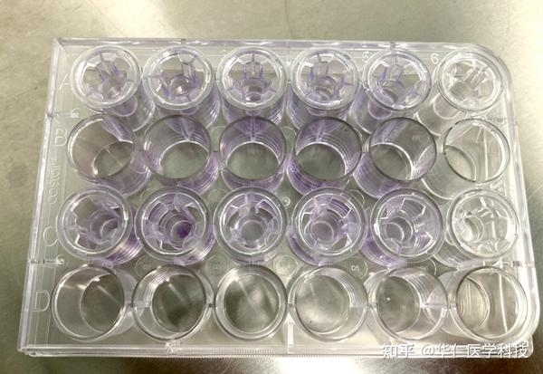 从青铜到王者，科研小白的进阶之路（5）——Transwell细胞侵袭实验教程 - 知乎